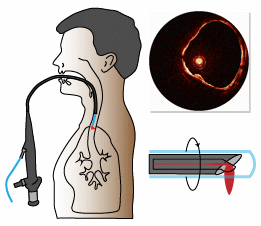 Coherence Imaging Lab -- Anatomical Optical Coherence Tomography